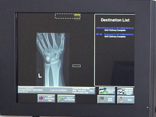 9. The picture comes up on a computer for the doctor to look at.A ...